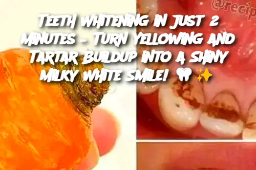 Teeth Whitening in Just 2 Minutes – Turn Yellowing and Tartar Buildup ...