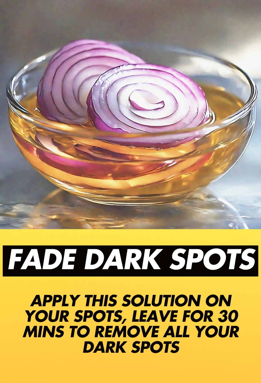 Onion and Apple Cider Vinegar to Fade Dark Spots – Best Recipes